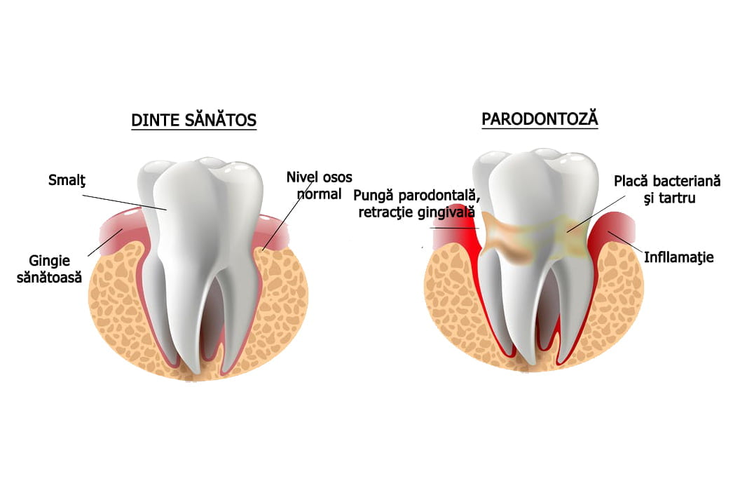 Parodontologie – Dental Palace®